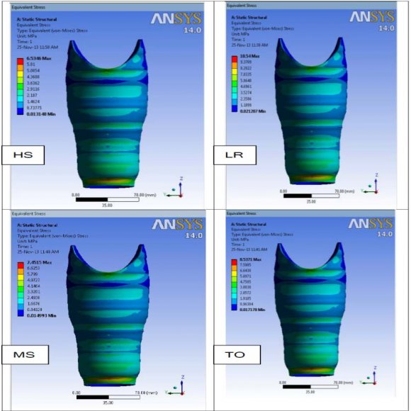 Mechanical Properties of Jute Nanofibres Reinforced Composites
